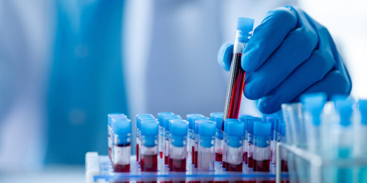 Oftalmologia - Uma nova abordagem para entender o glaucoma - Universo ...