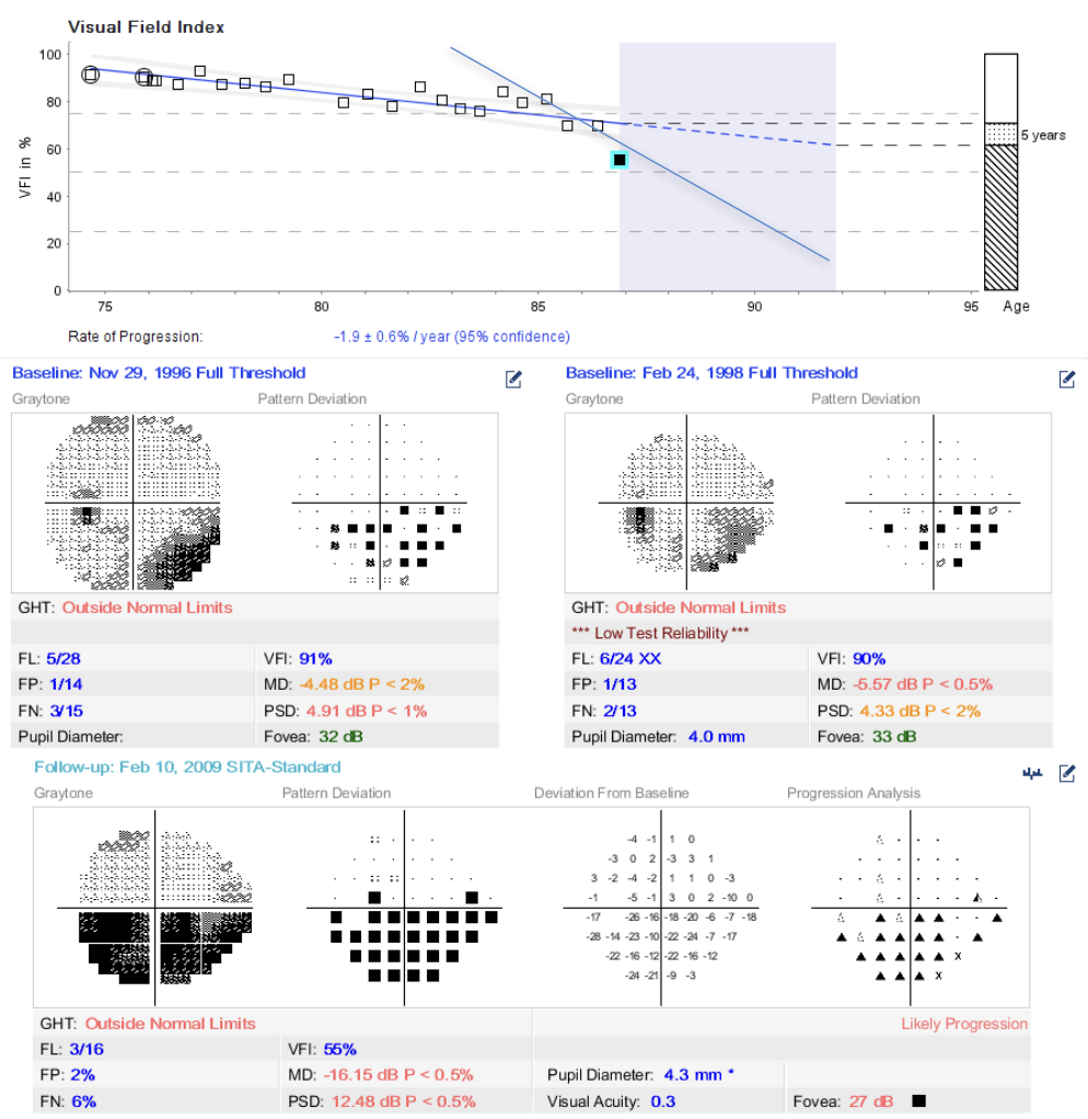 Oftalmologia - 10 Pérolas e armadilhas na interpretação do campo visual ...